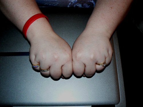A missing knuckle, is there a name for such a deformation?